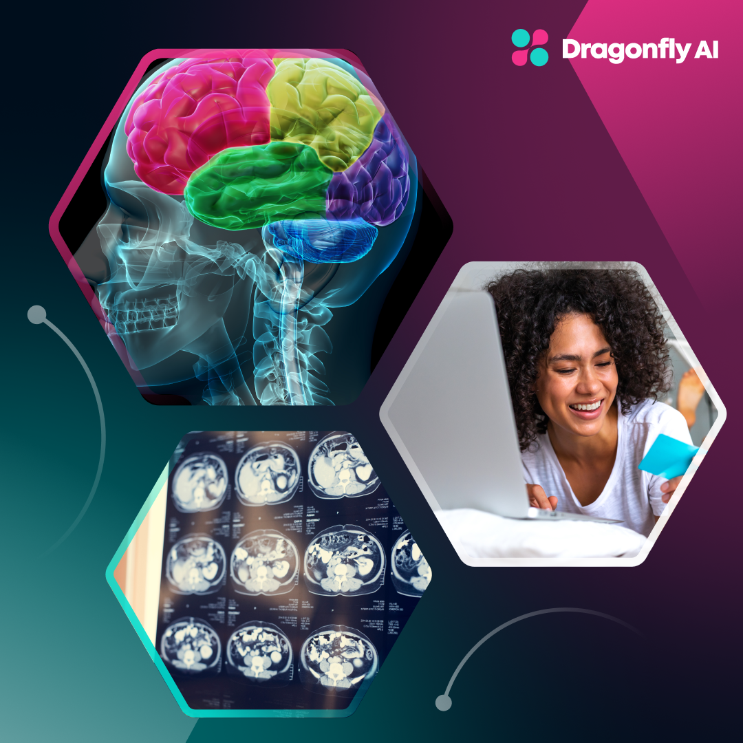 What is Neuromarketing? - Ecommerce Neuromarketing with AI